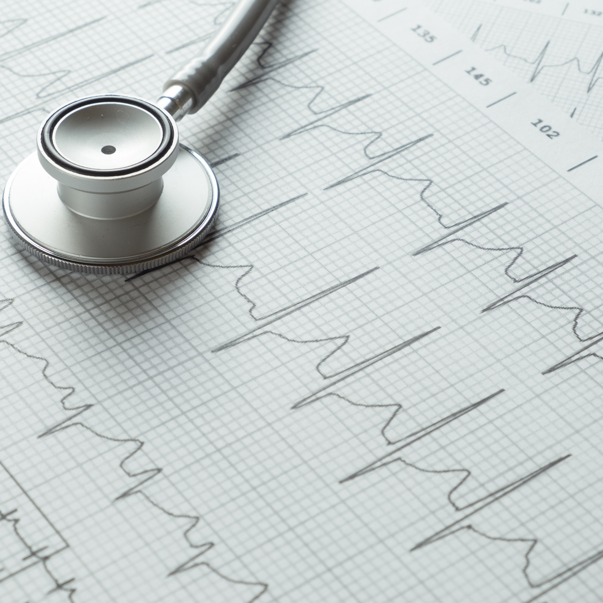 5 Key Advantages of the Midmark IQ ECG Digital Ekg Iqecg Casing for Ad — Boca Med Tech